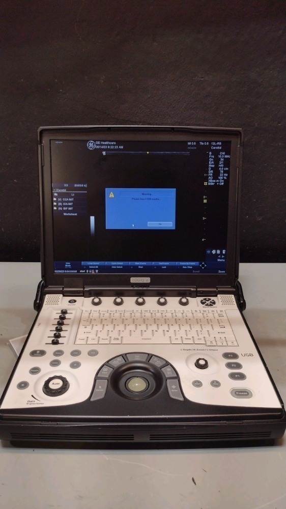 GE LOGIQ E PORTABLE ULTRASOUND MACHINE (SERIAL# 480002WX5) (DOM: 1/2016)