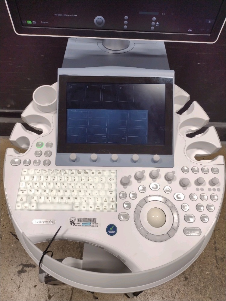 GE VOLUSON E8 ULTRASOUND MACHINE (SERIAL# E36795) (DOM: 6/2017 ...